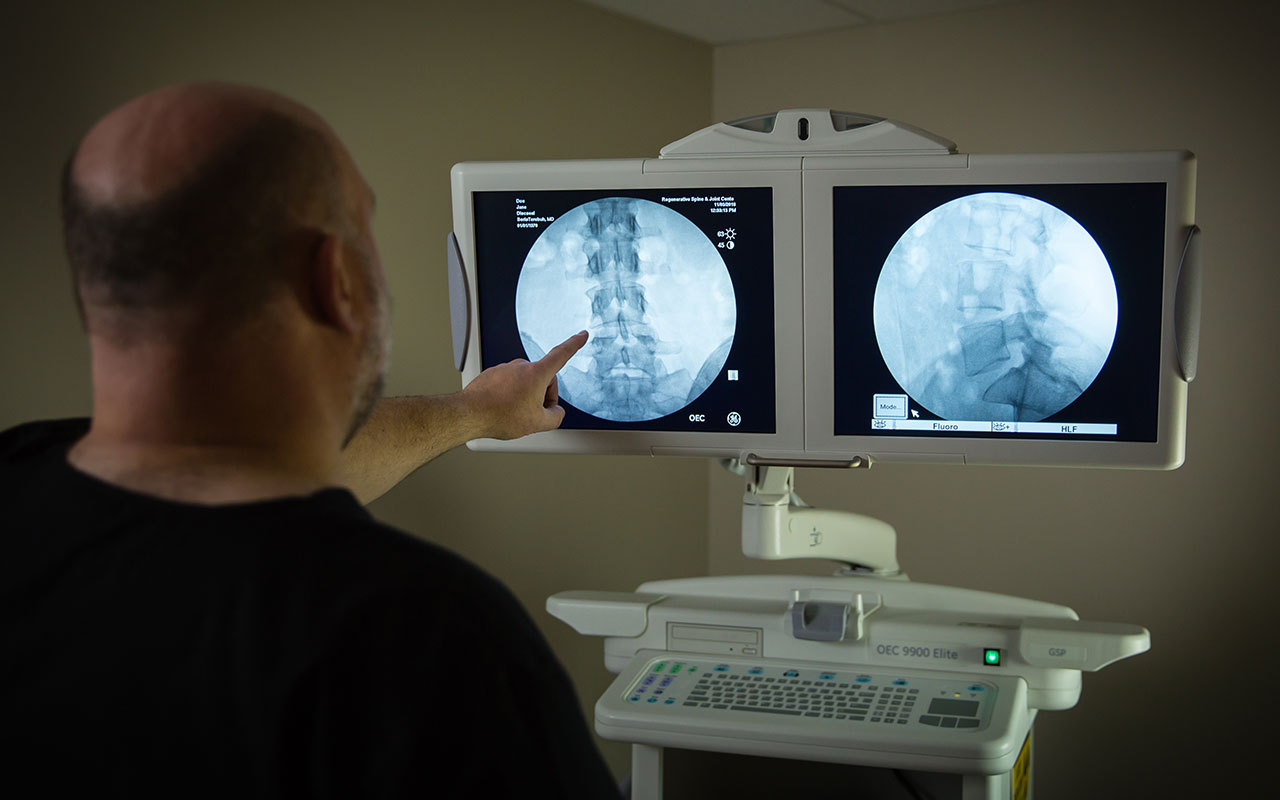The Discseel® Procedure - Regenerative Spine And Joint