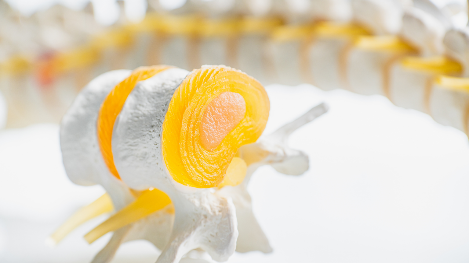 A Good Reason to Second Guess Stem Cell Injections into Your Spine ...