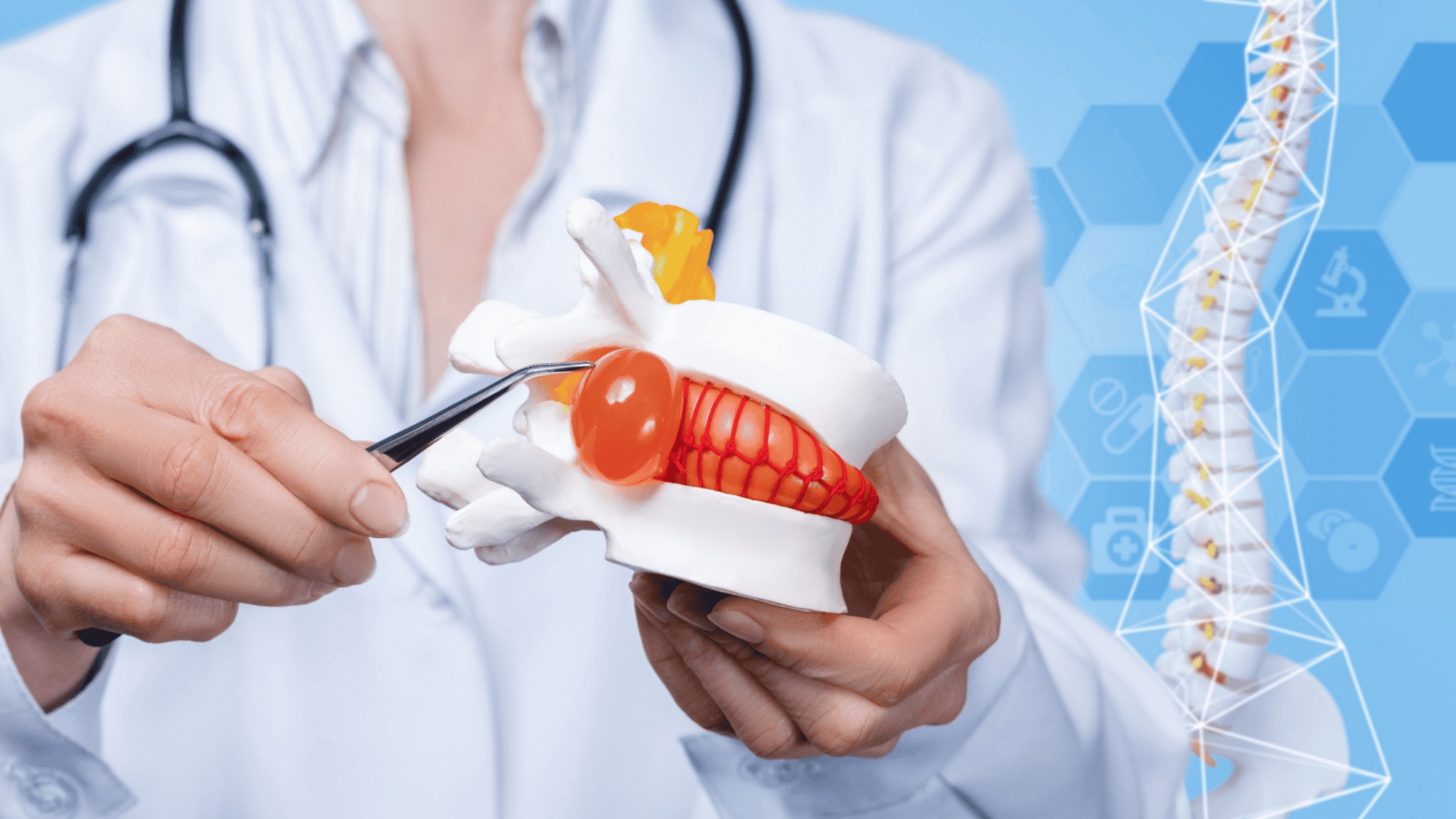 How A Lumbar Disc Herniation Can Improve Without Surgery - Regenerative ...